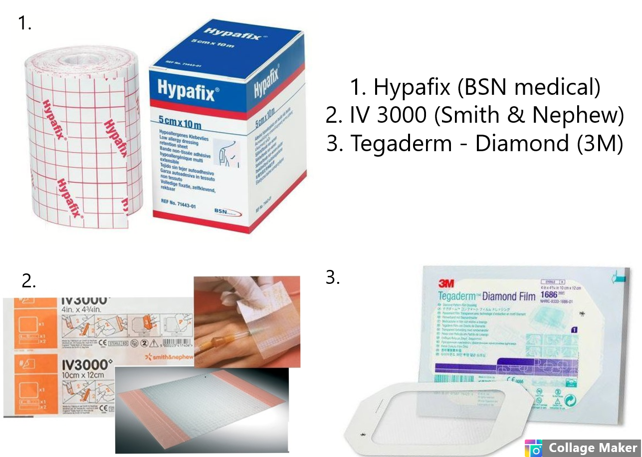How to secure the NG tube – Breaking ice around Nasogastric Tube